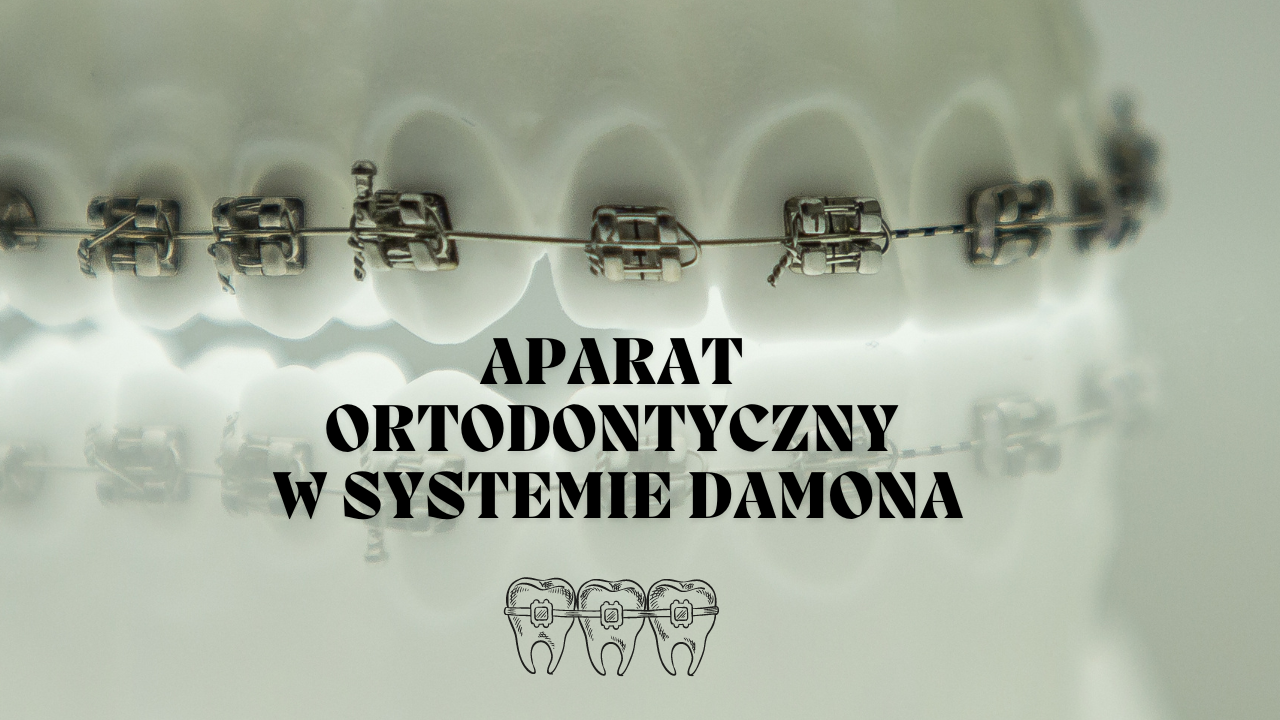 Aparat ortodontyczny w systemie Damona - Denteamed - lublin stomatolog