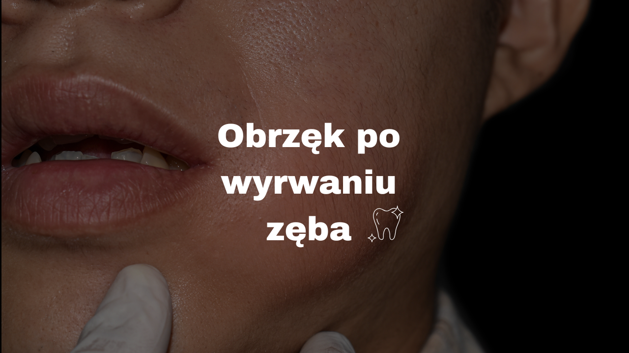 Obrzęk po wyrwaniu zęba - Denteamed - lublin stomatolog